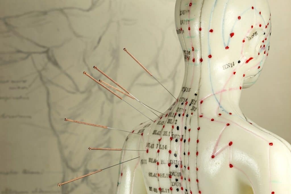 New For 2023 Acupuncture CPT Codes For Medical Billing Holistic